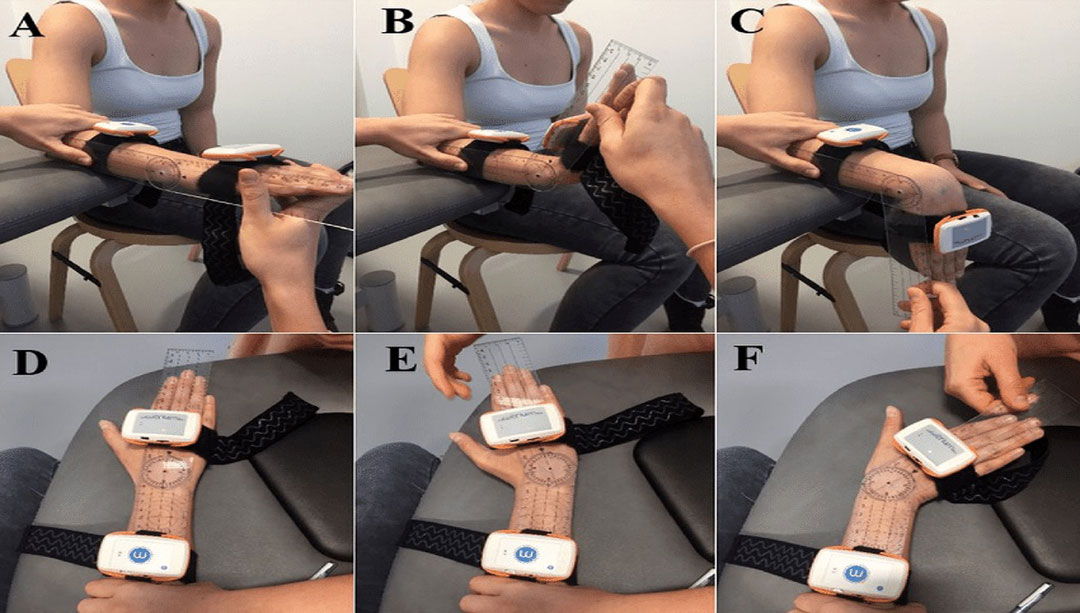Wrist Goniometer – telepatron